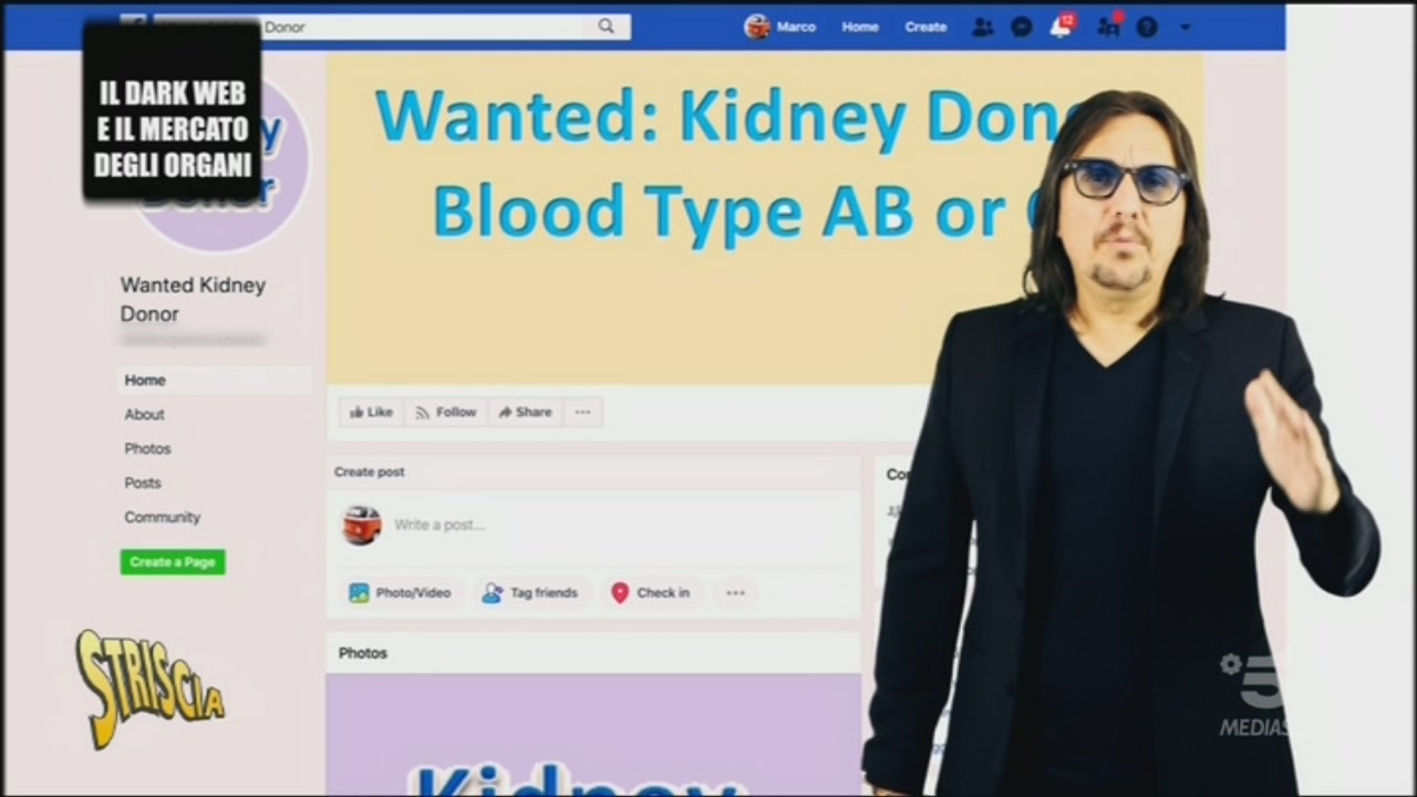 Il Dark Web e il mercato degli organi - Striscia la notizia