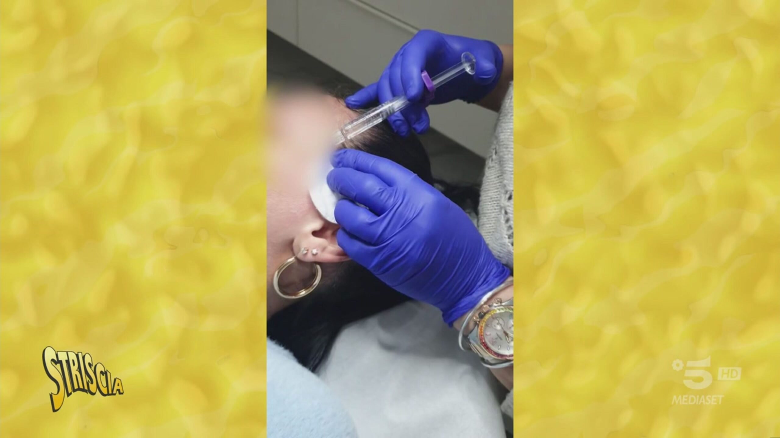 Lady botox, l’operatrice estetica abusiva - Striscia la notizia